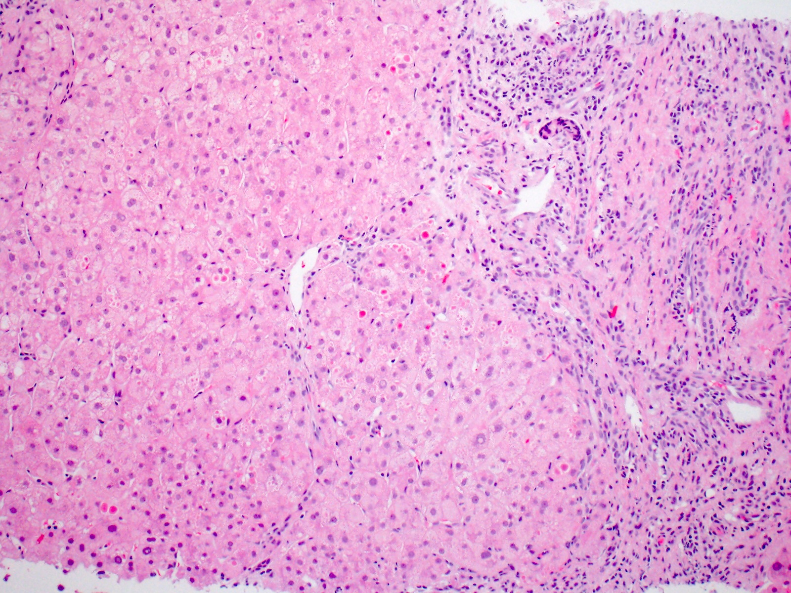 Pathology Outlines - Case of the Month #554