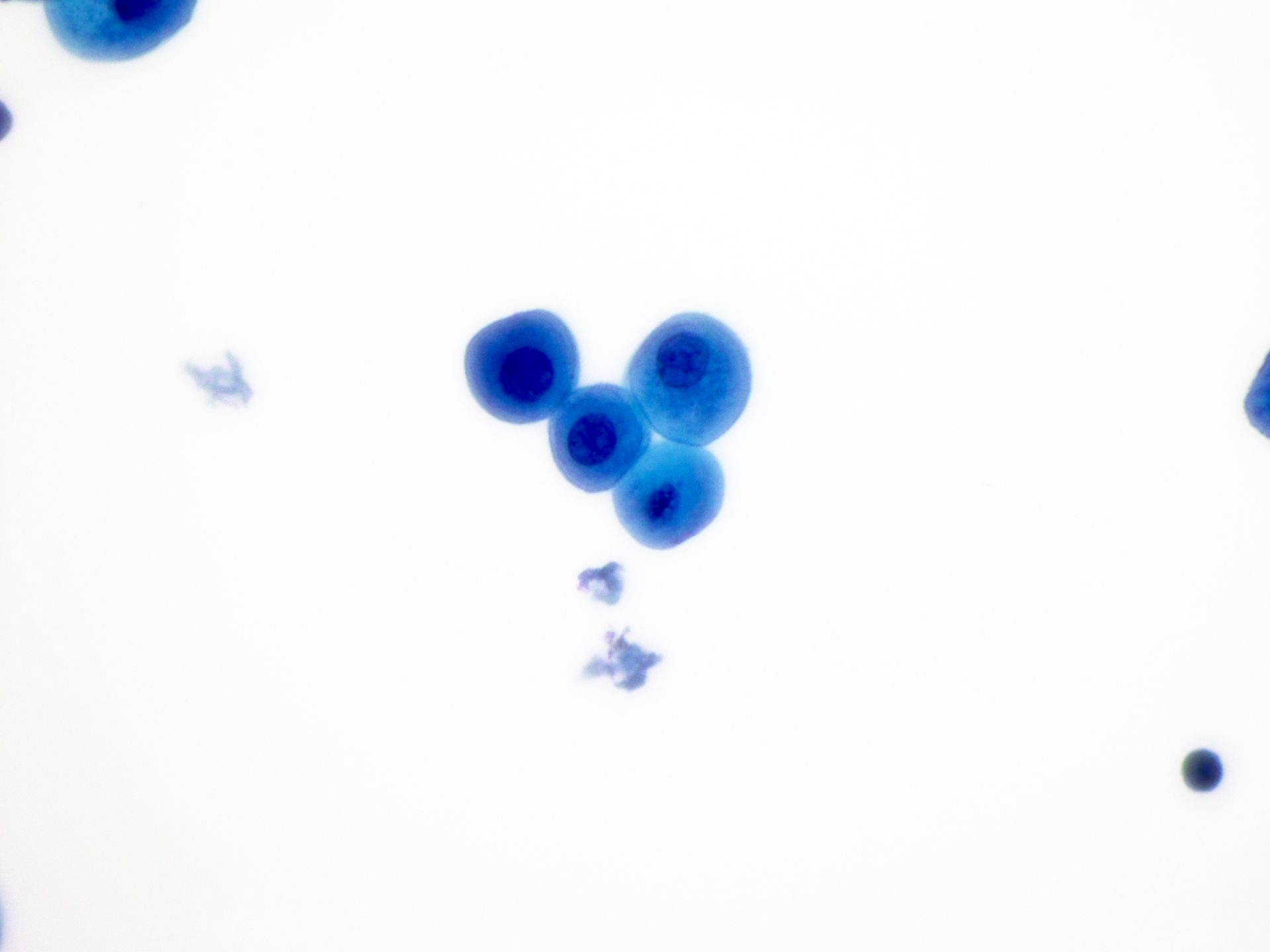 Pathology Outlines - Cytology-general, normal findings & biomarker testing