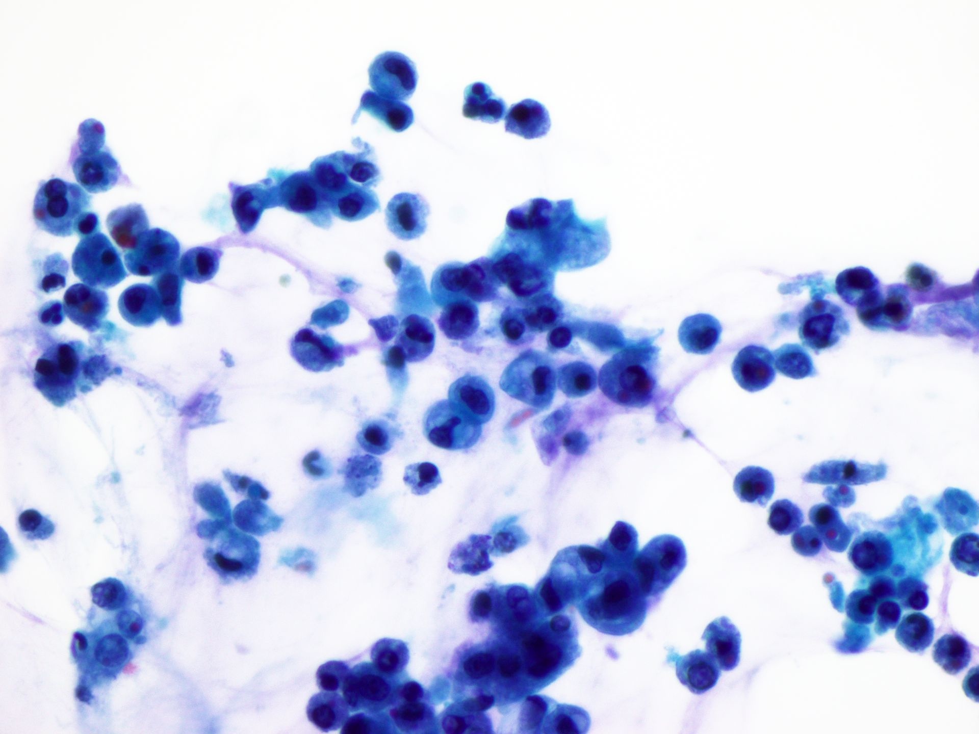 Pathology Outlines - Cytology-general, normal findings & biomarker testing