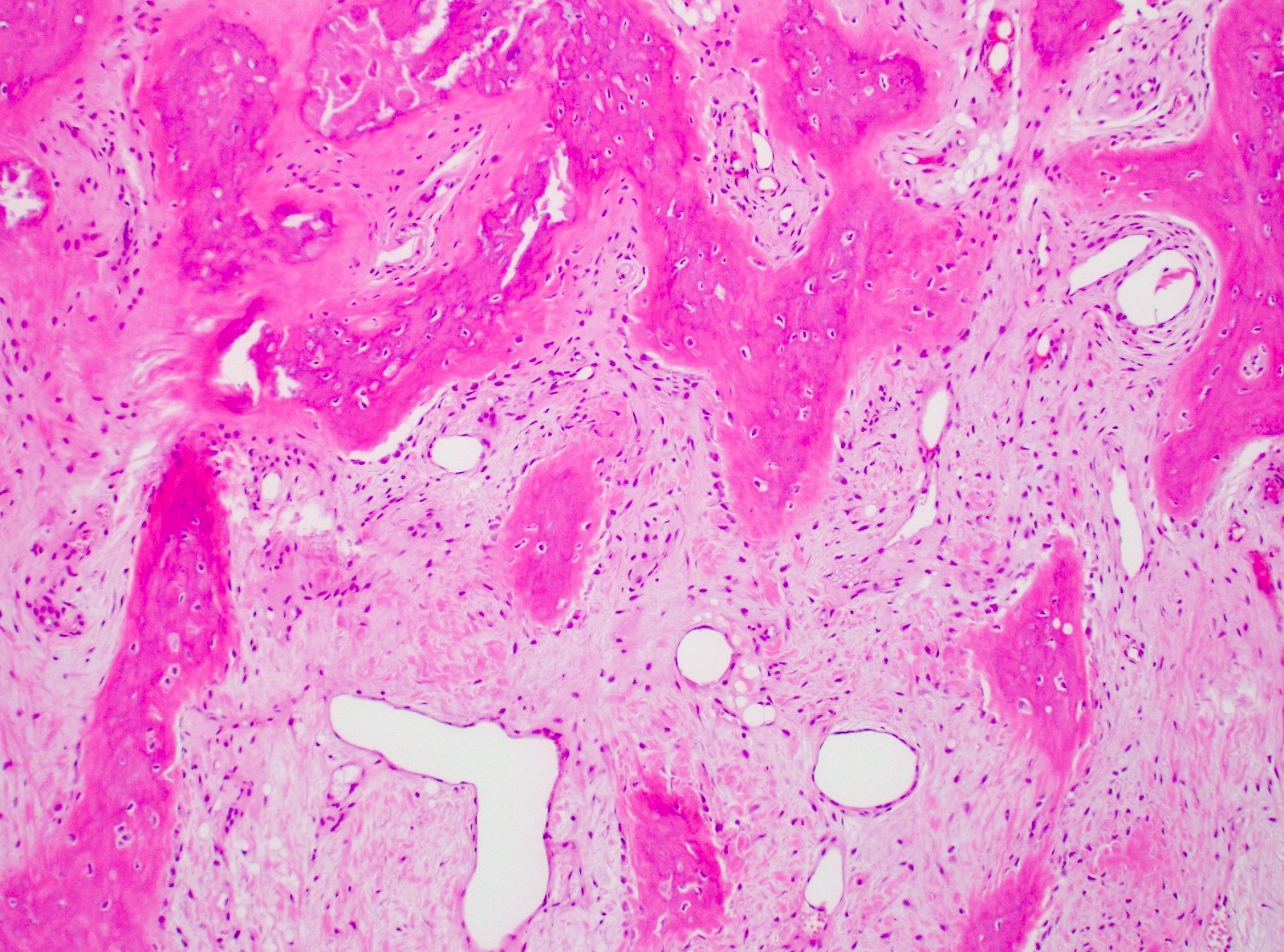 Pathology Outlines - Fracture