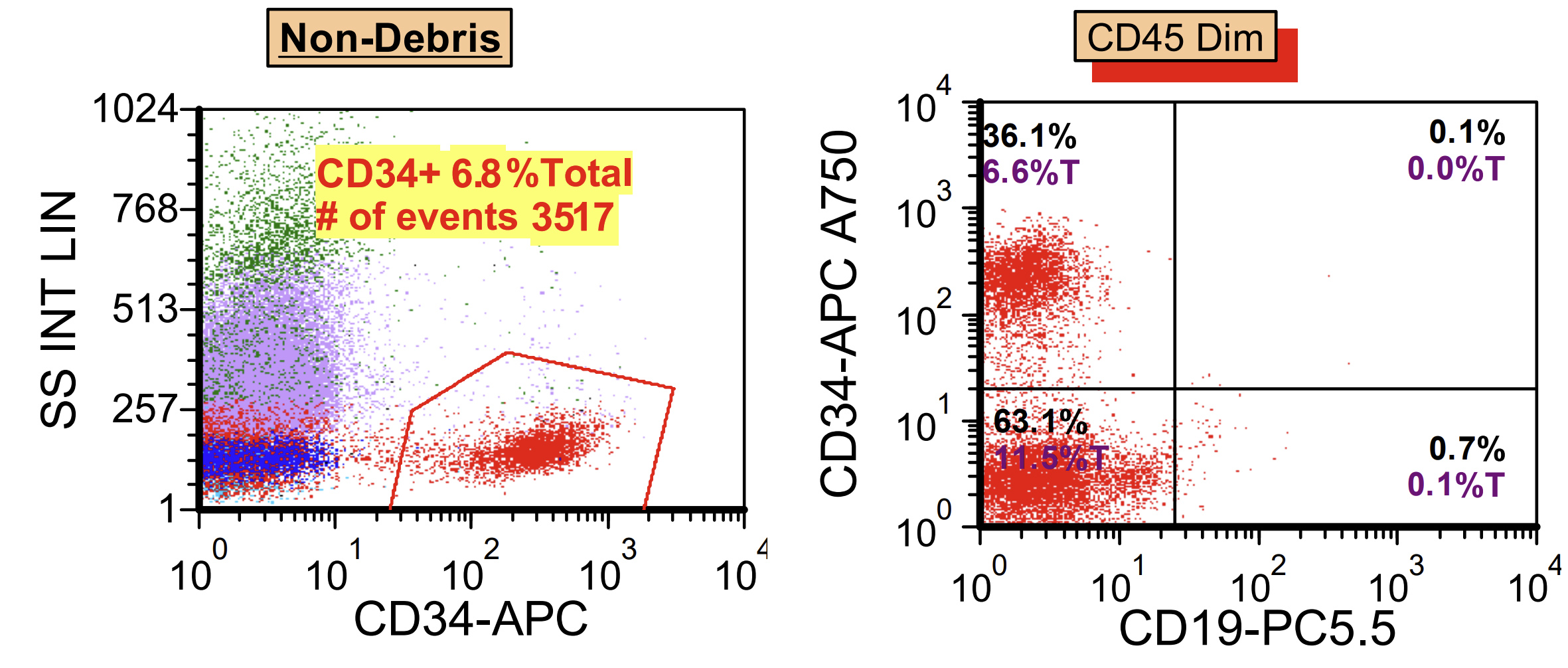 Pathology Outlines - MDS prognostic scoring