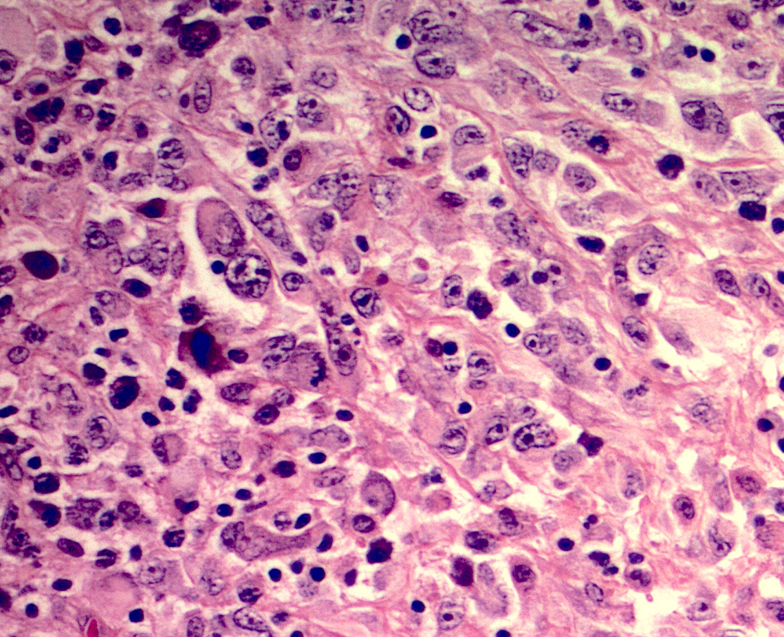 Pathology Outlines - Question Bank