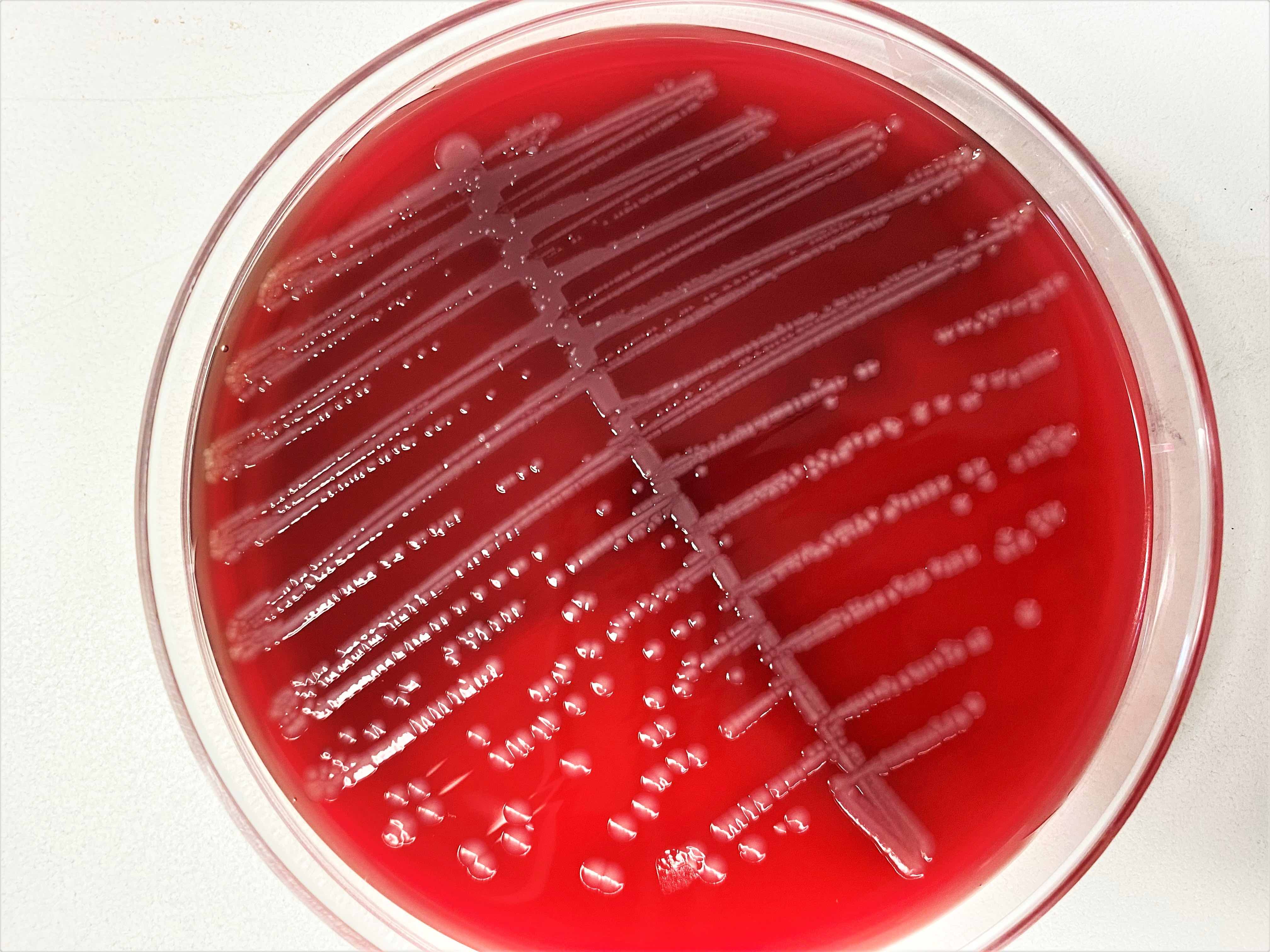 Blood Agar E Coli