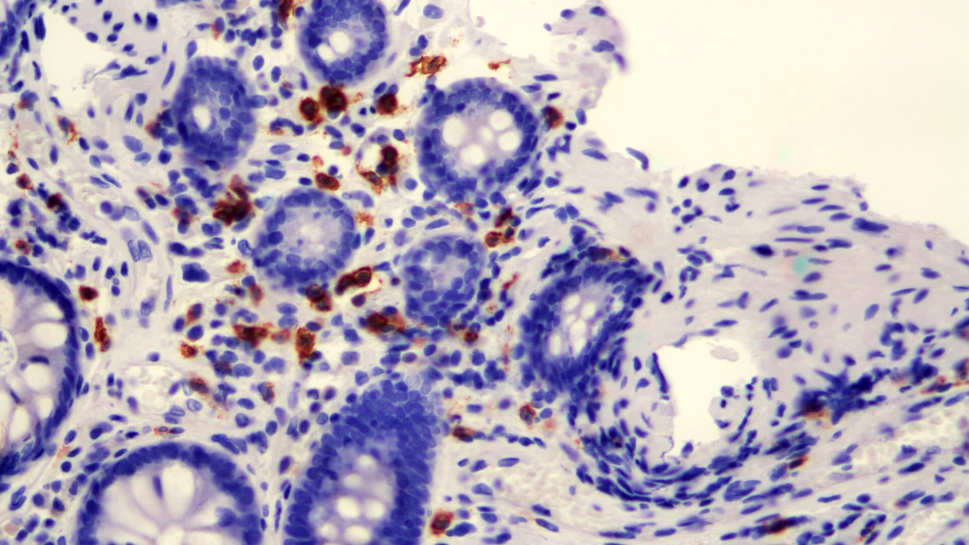 Mast Cells Histology