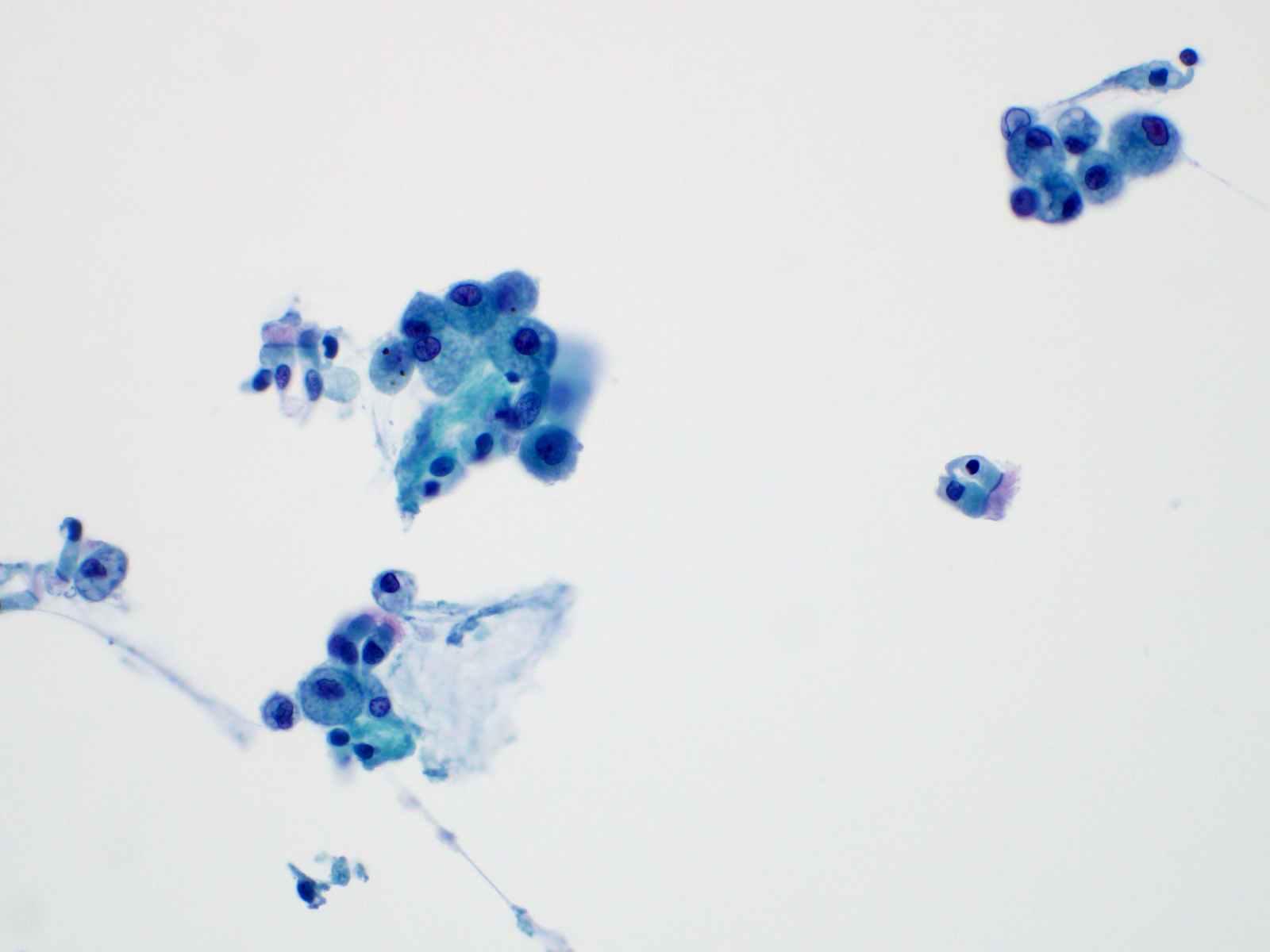 Pathology Outlines - Benign