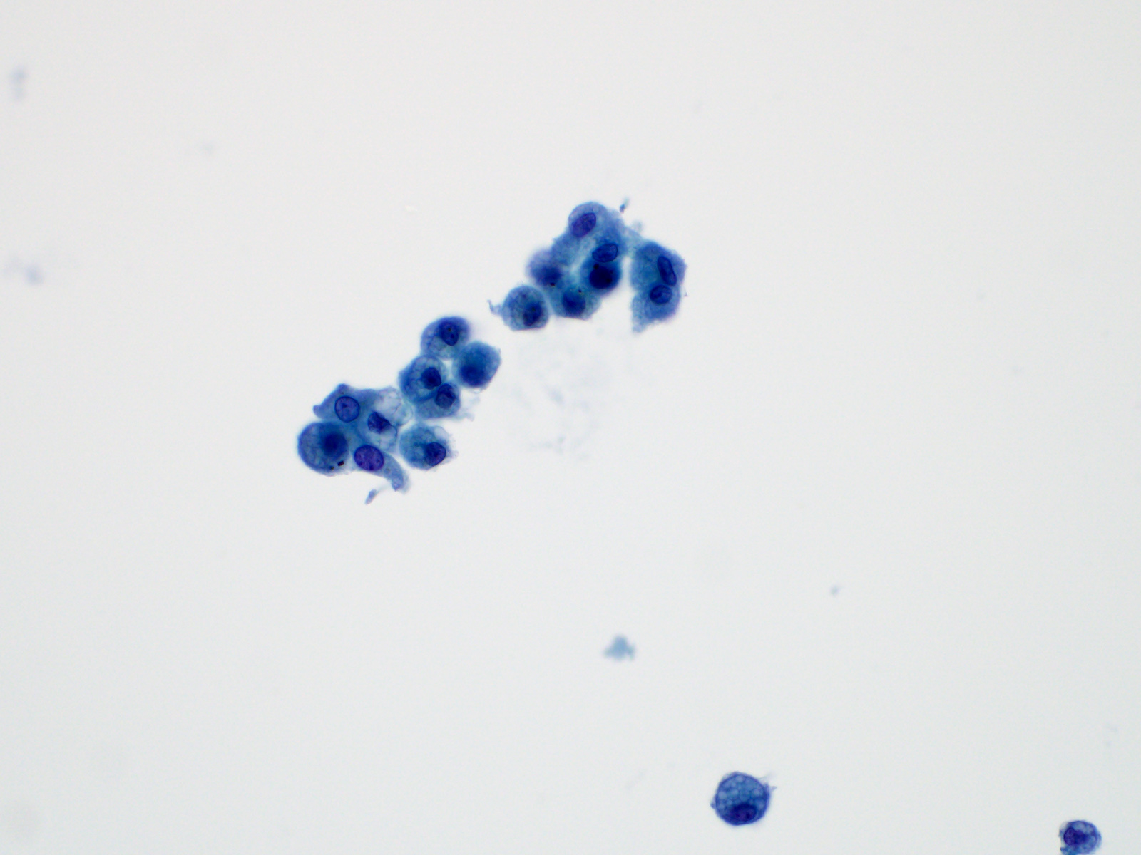 Pathology Outlines - Benign