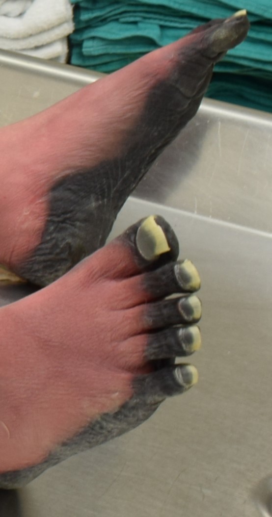 Pathology Outlines - Postmortem changes