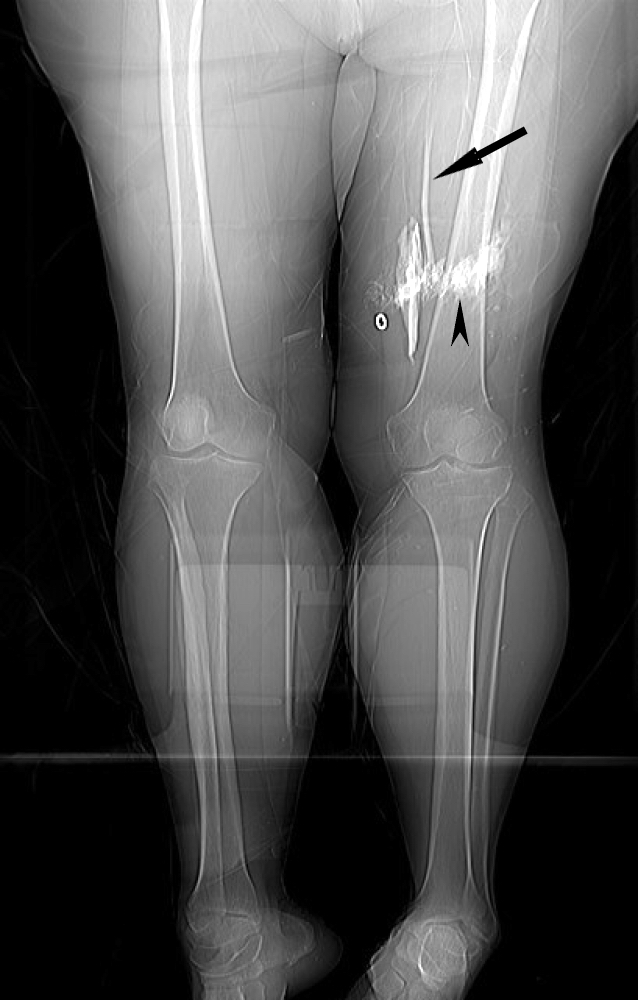 Pathology Outlines - Forensic radiology