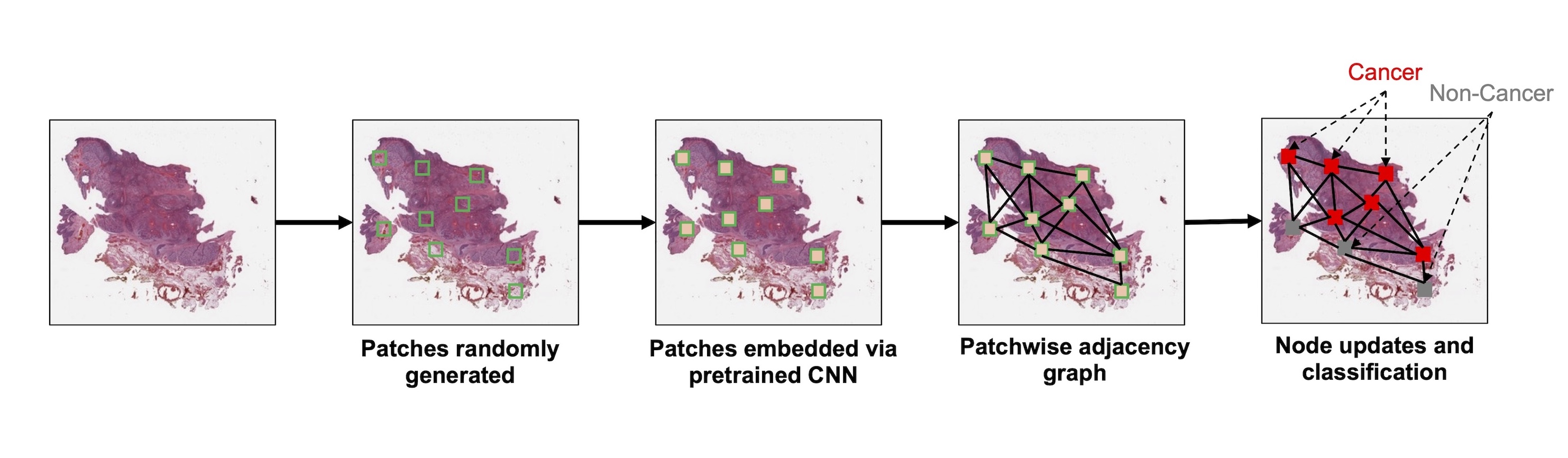 Pathology Outlines - Application of graph neural networks to whole ...