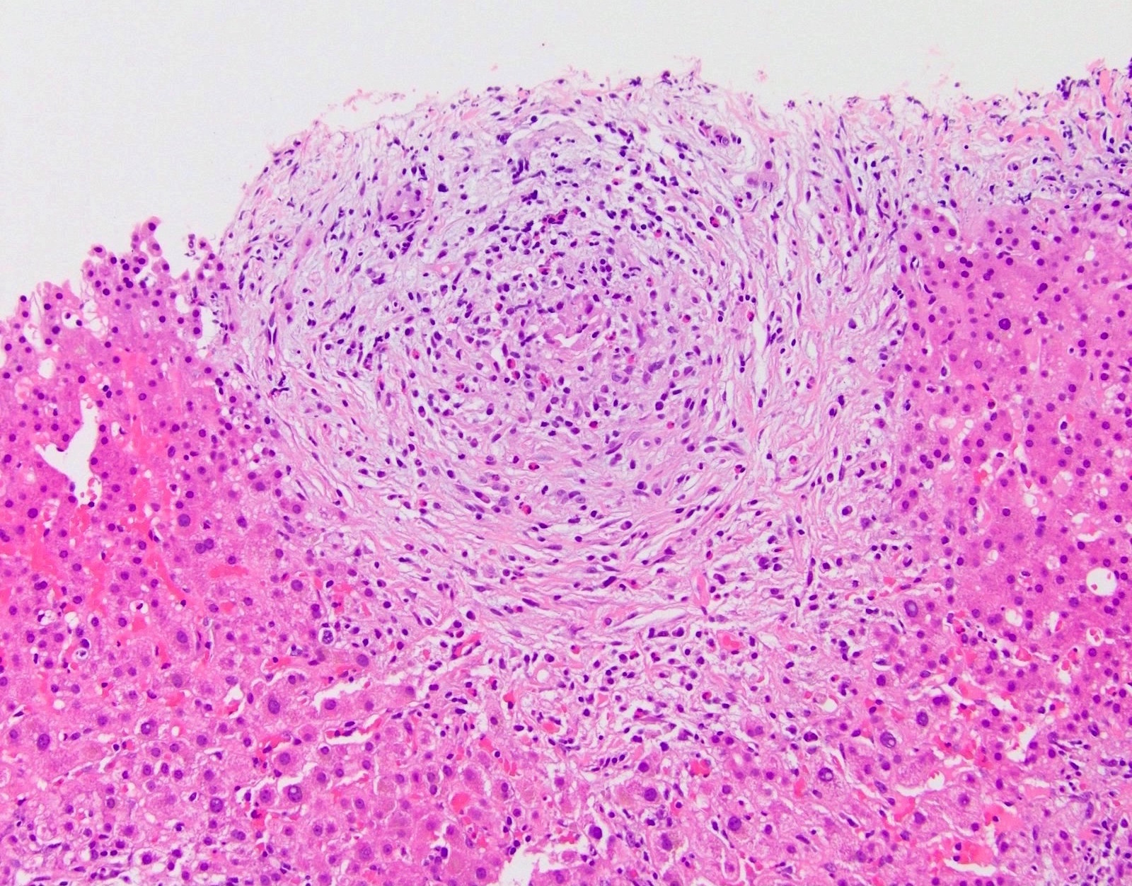 Pathology Outlines - Board Review Style Questions