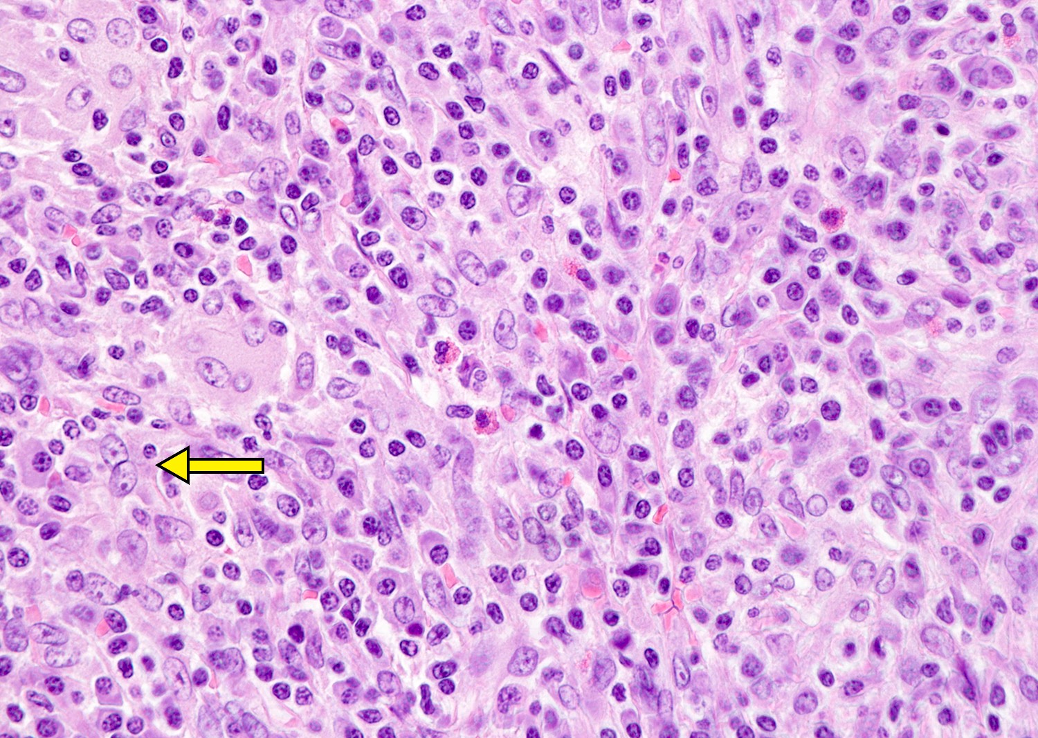Pathology Outlines - Question Bank