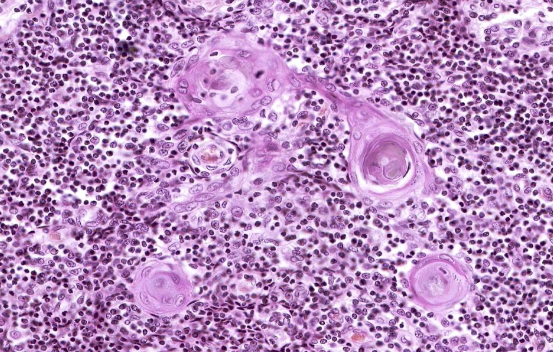 Thymus Histology Thymus Morphology And T Cell Maturation — OrganAxis