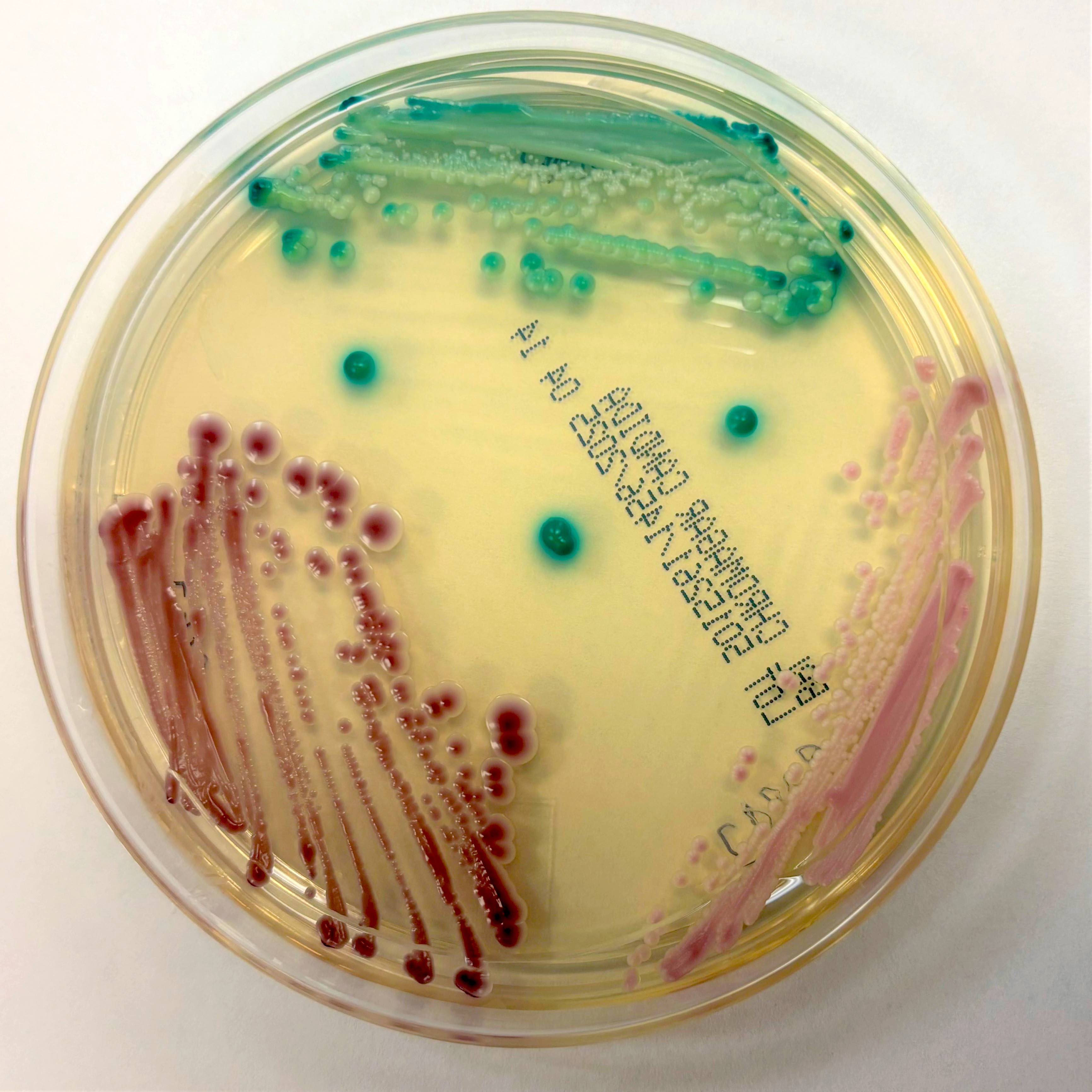 Pathology Outlines - Candida species