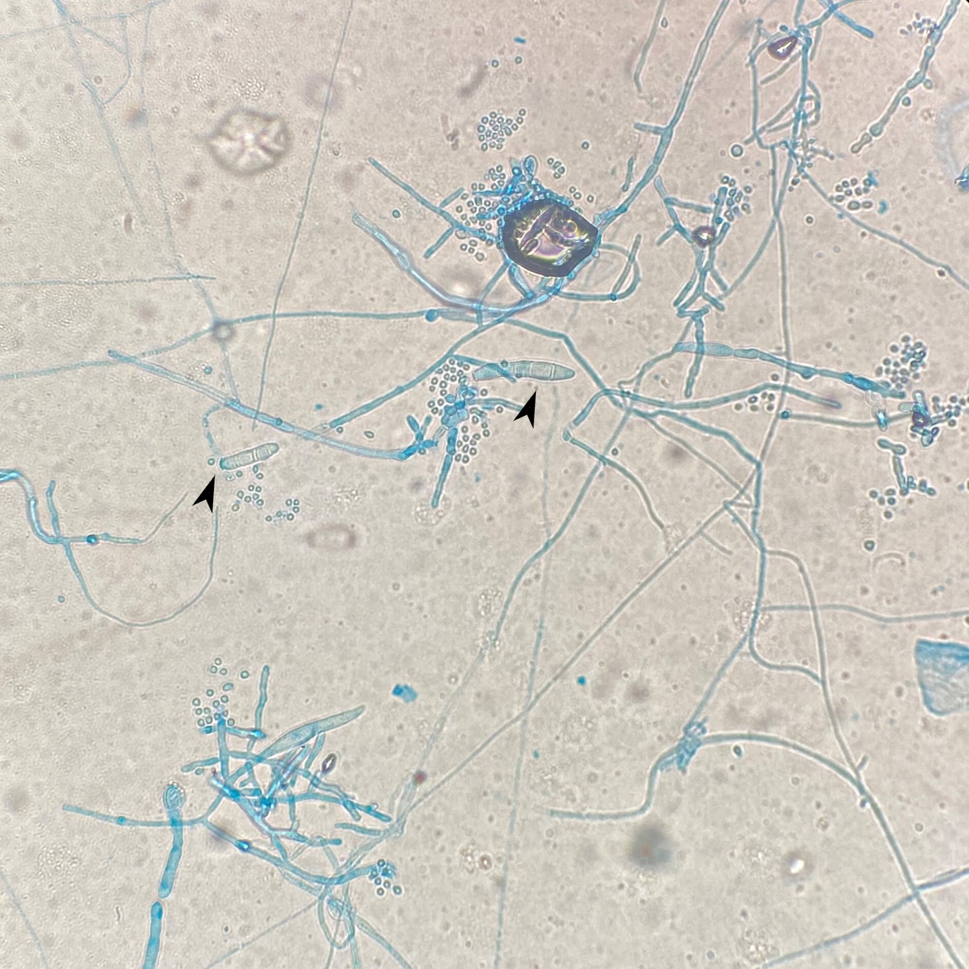 Pathology Outlines - Dermatophytes