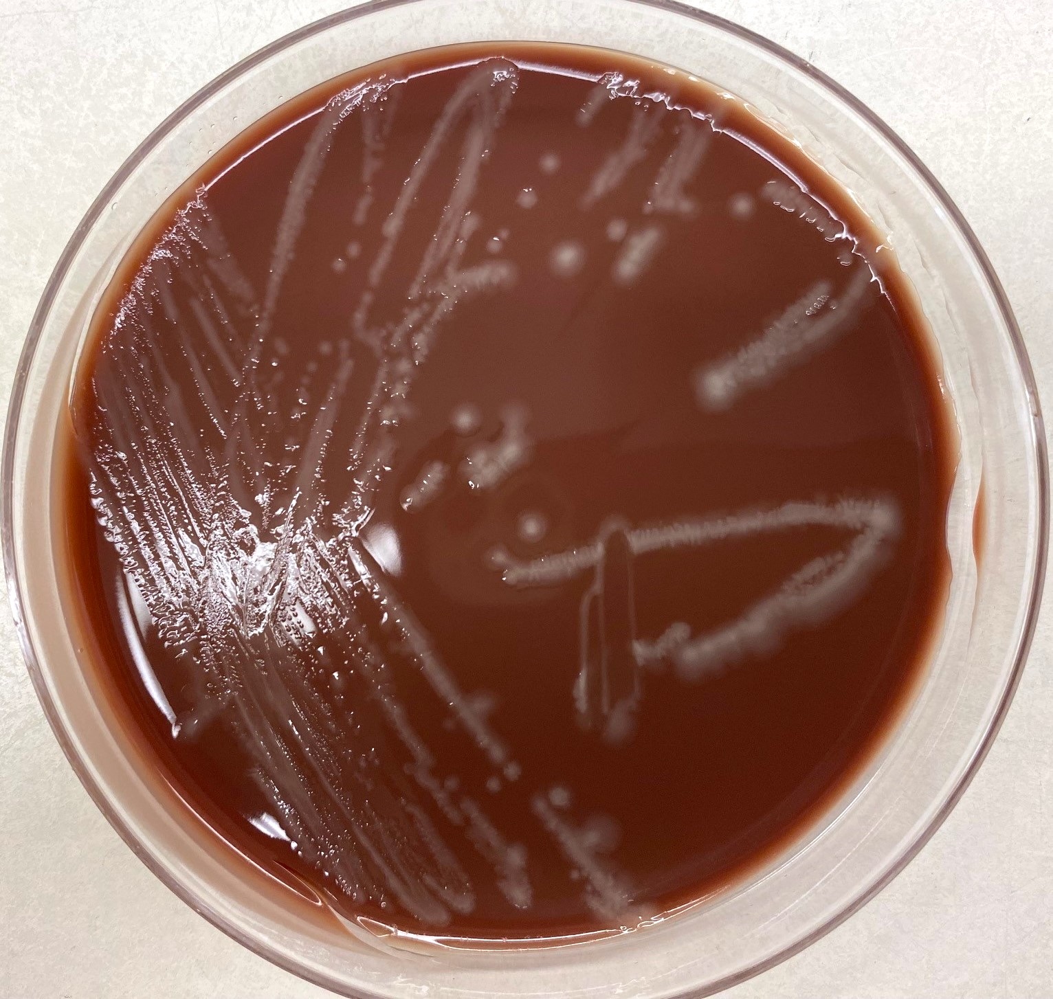 Pathology Outlines - Haemophilus influenzae
