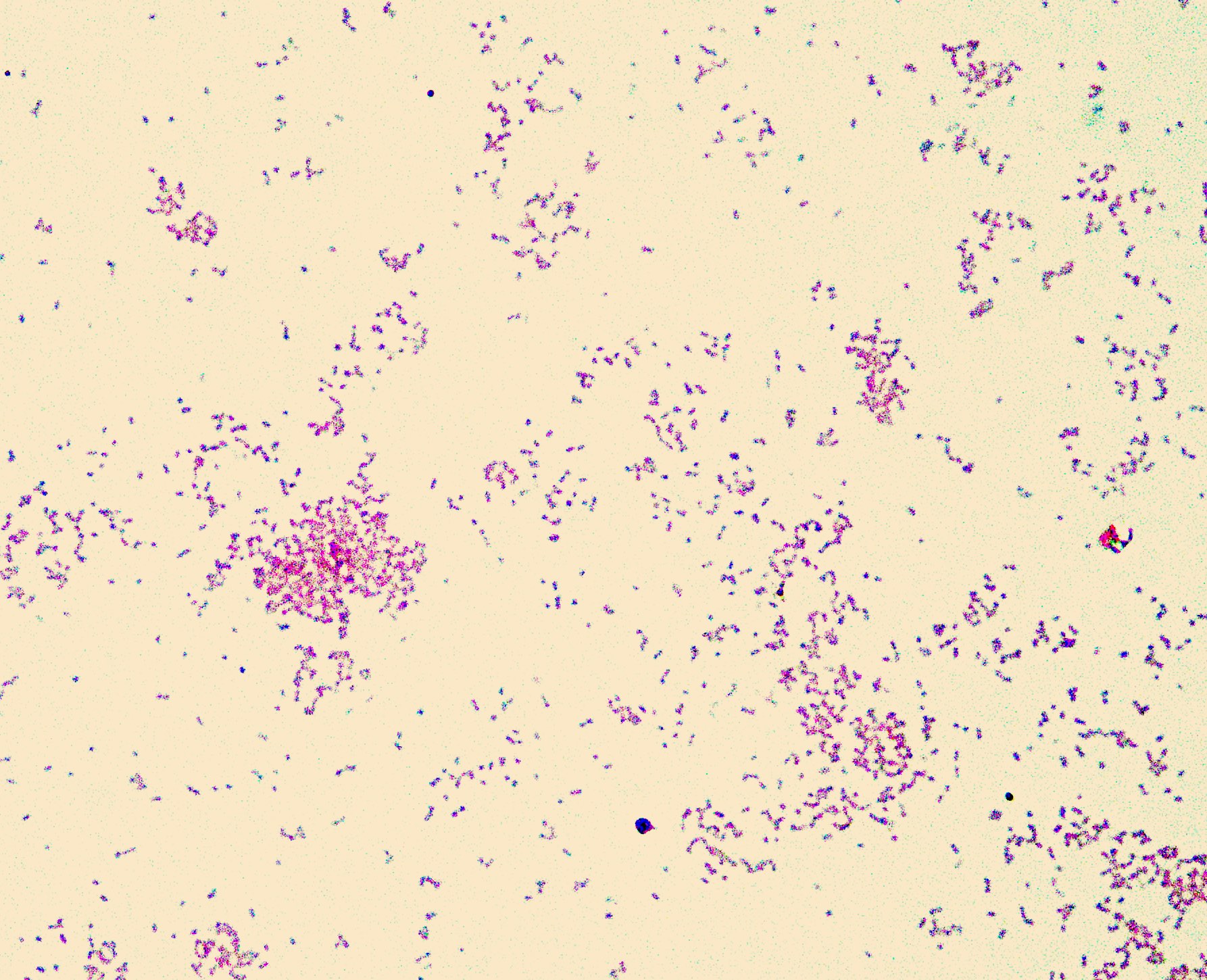 Haemophilus Influenzae Type B Symptoms