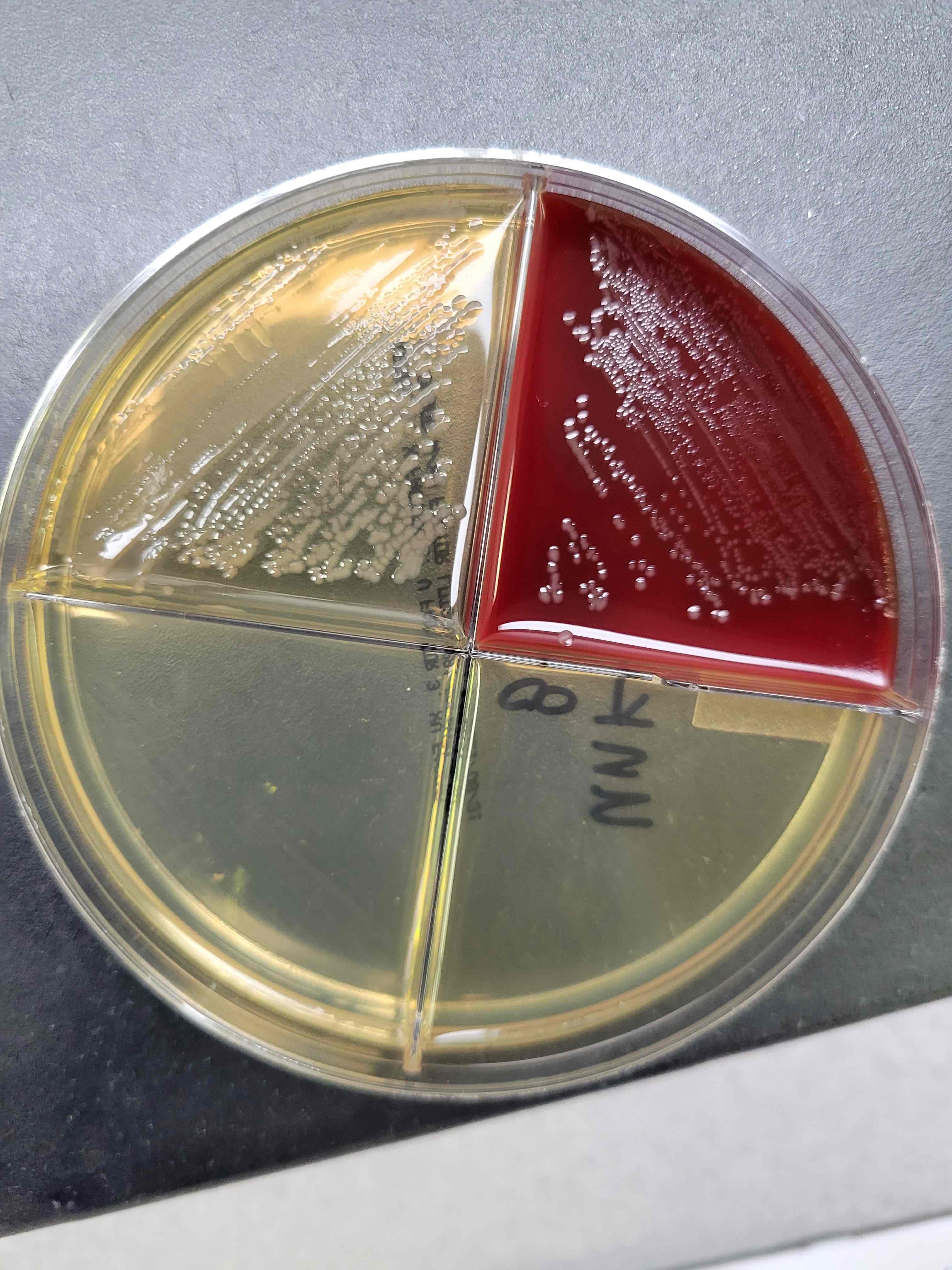 Pathology Outlines - Haemophilus influenzae