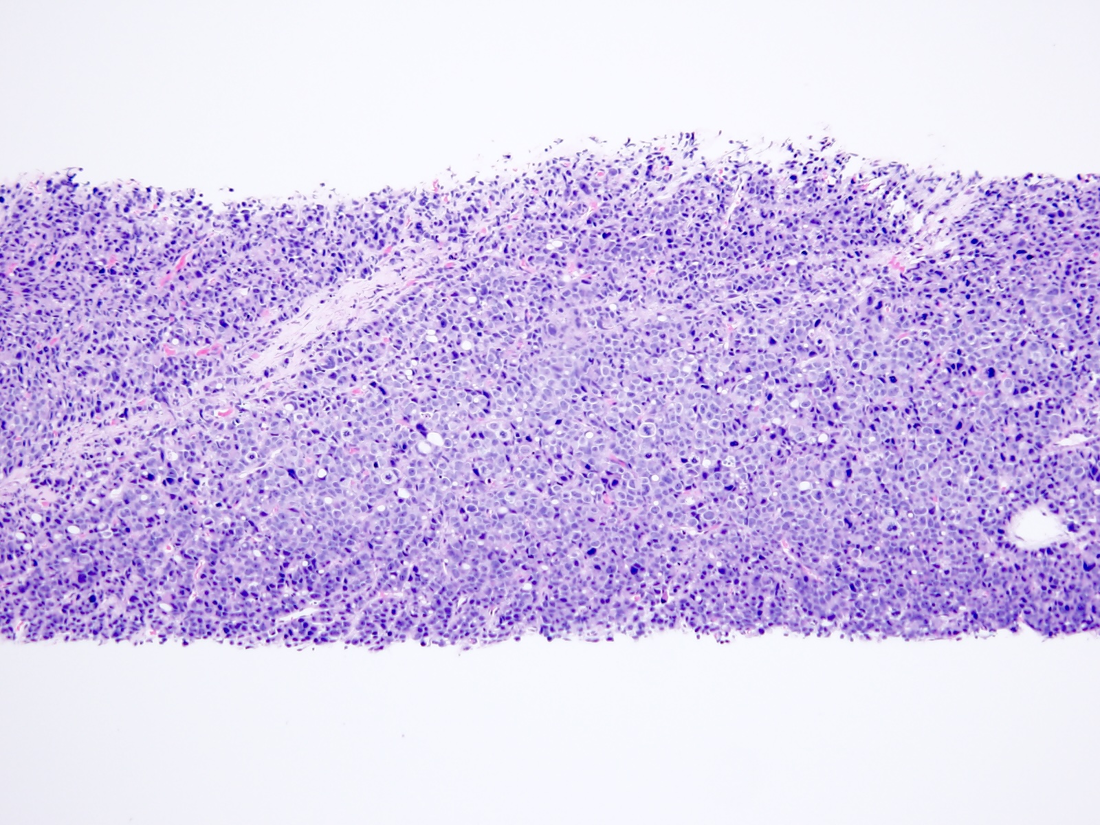 Pathology Outlines - WHO classification