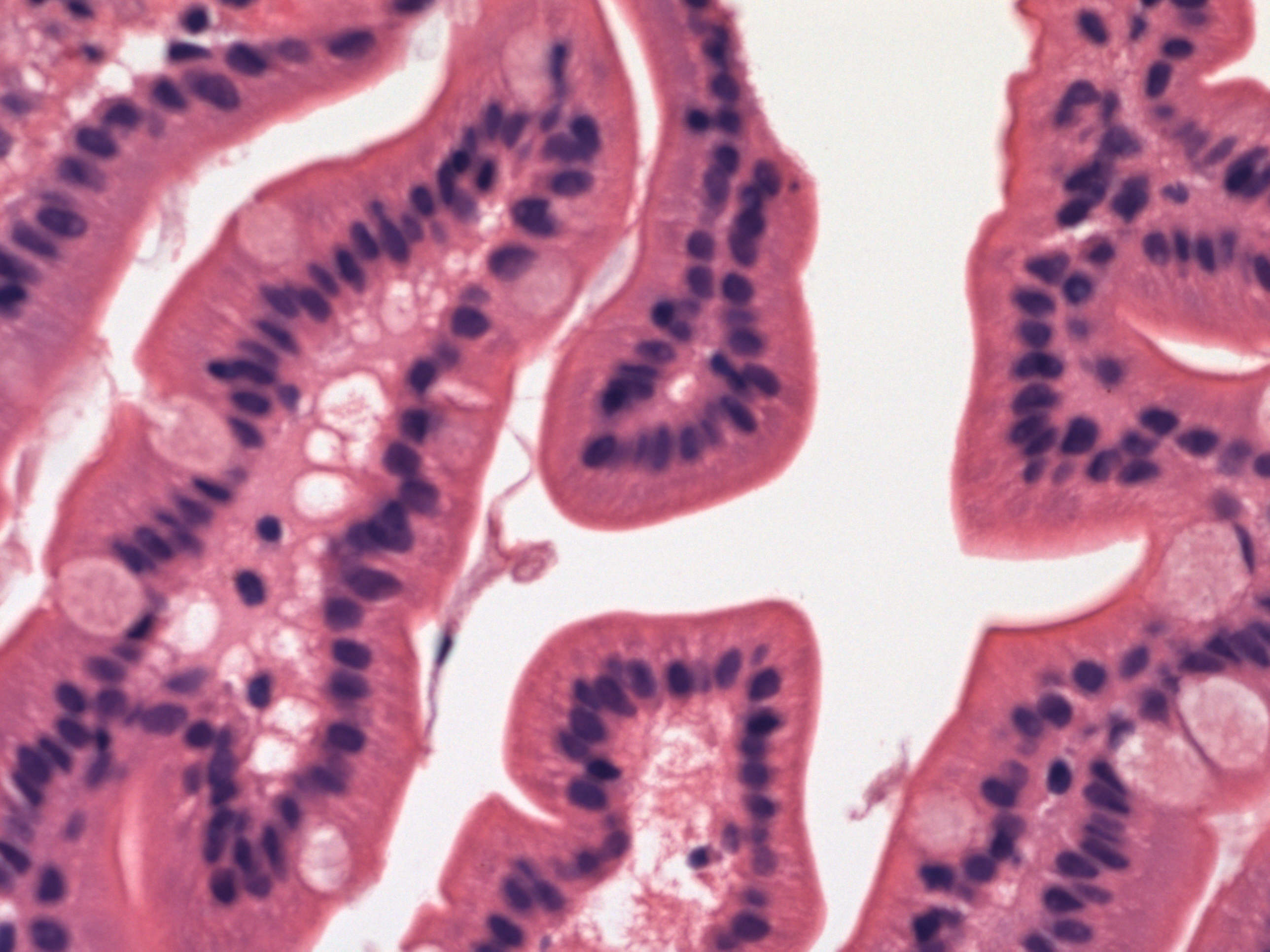 Pathology Outlines - Anatomy