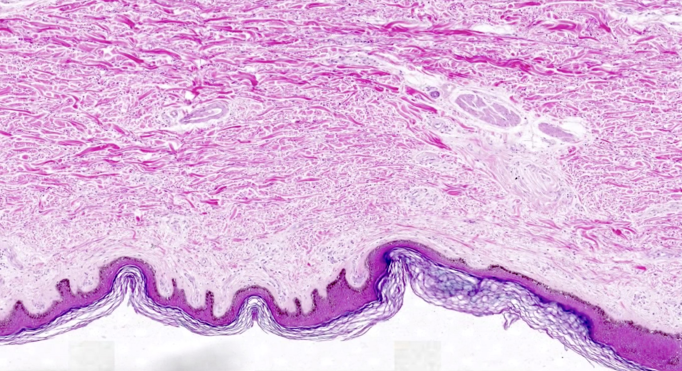 Pathology Outlines - Histology-fibrous tissue & nerve