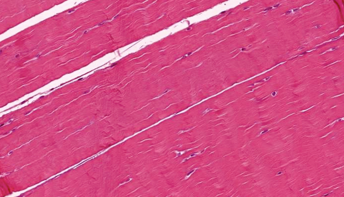 Pathology Outlines - Histology-fibrous tissue & nerve