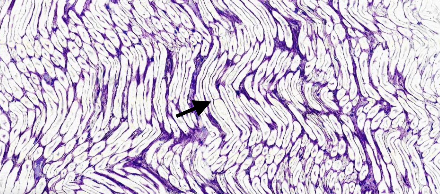 Loose Fibrous Connective Tissue