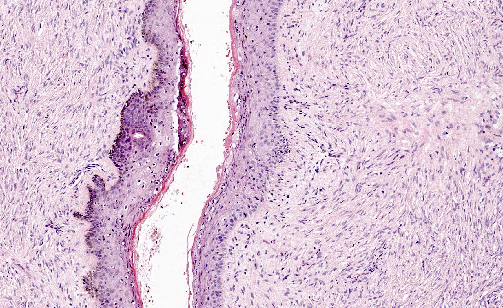 Pathology Outlines - Histology-fibrous tissue & nerve