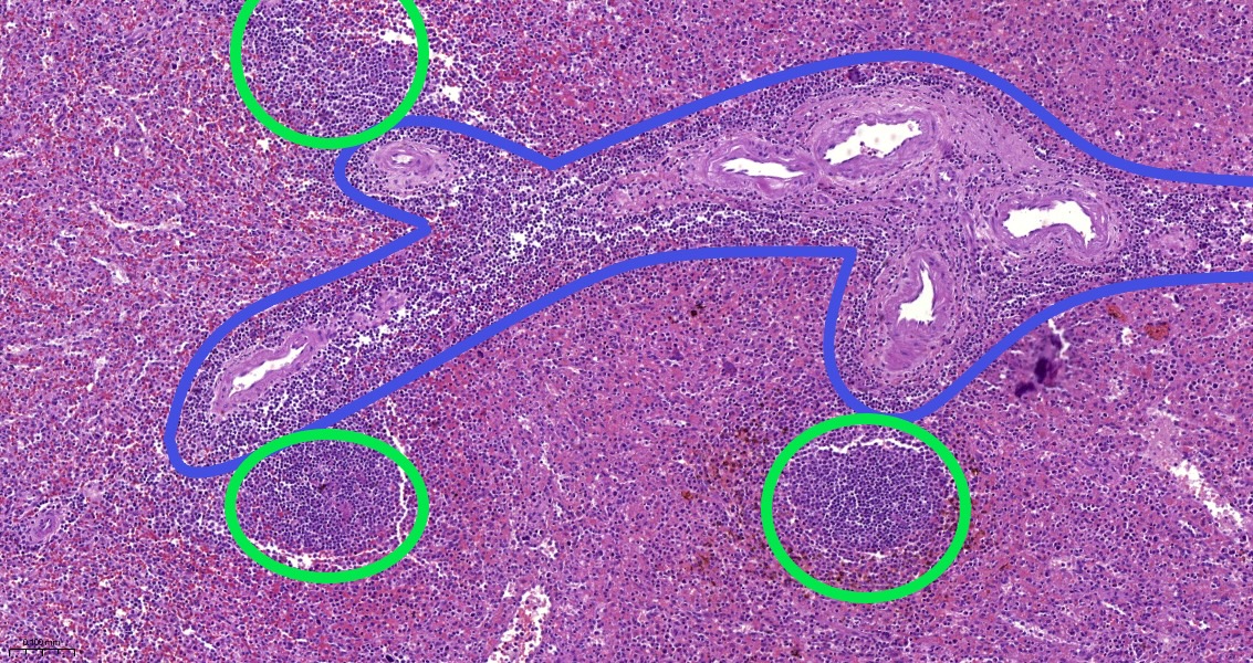 Pathology Outlines - Anatomy, histology & grossing-spleen