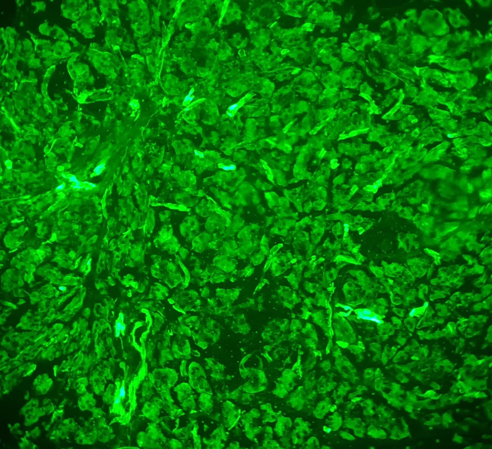 Pathology Outlines - C4d