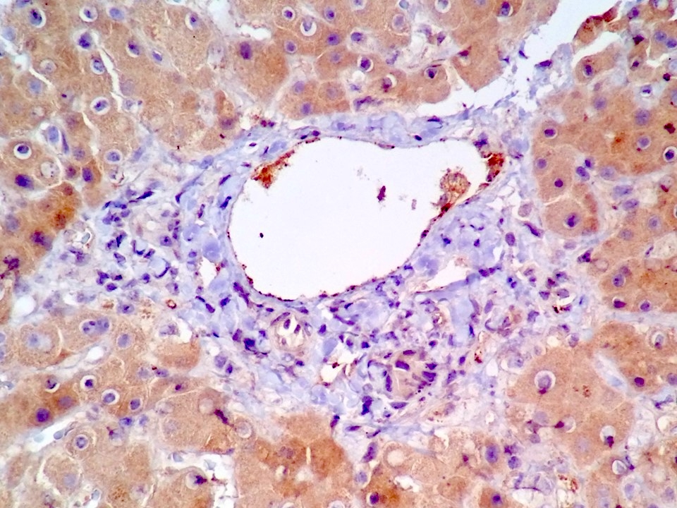 Pathology Outlines - C4d