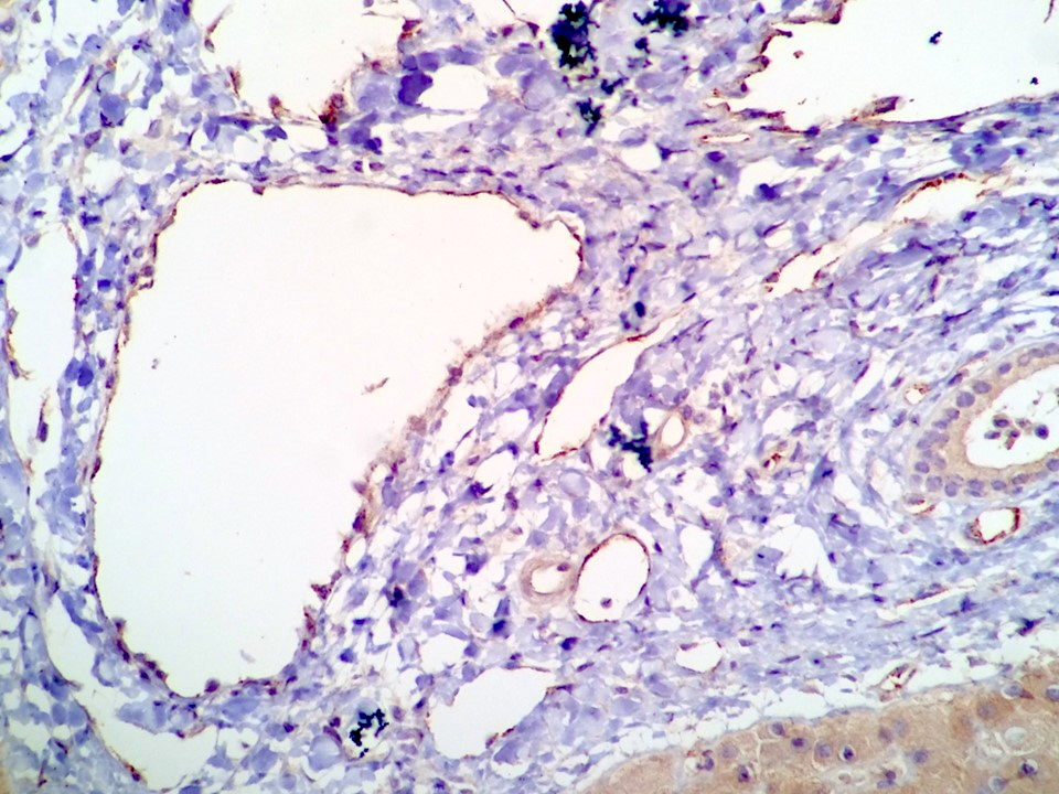 Pathology Outlines - C4d