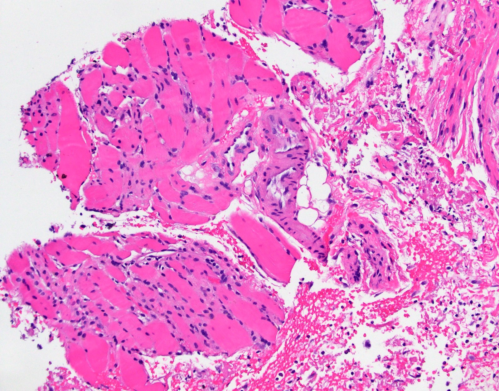 Pathology Outlines Egfr Mutation Specific Antibodies