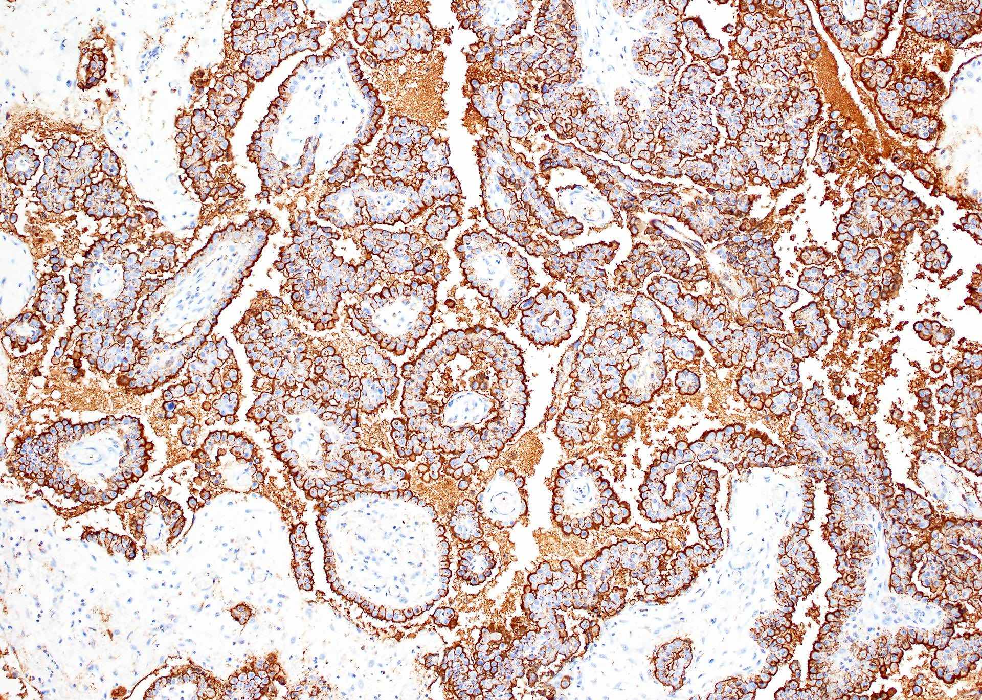 Pathology Outlines - HBME