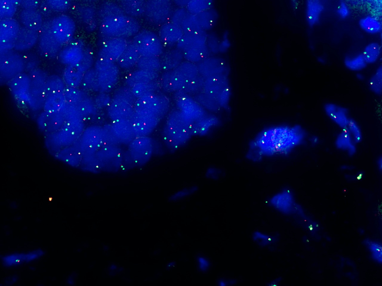 Pathology Outlines - PLAG1