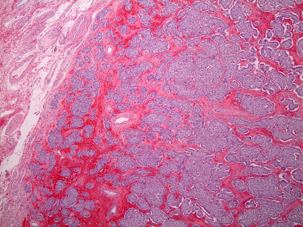 9 November 2023: Textbook Updates – Blog | PathologyOutlines.com