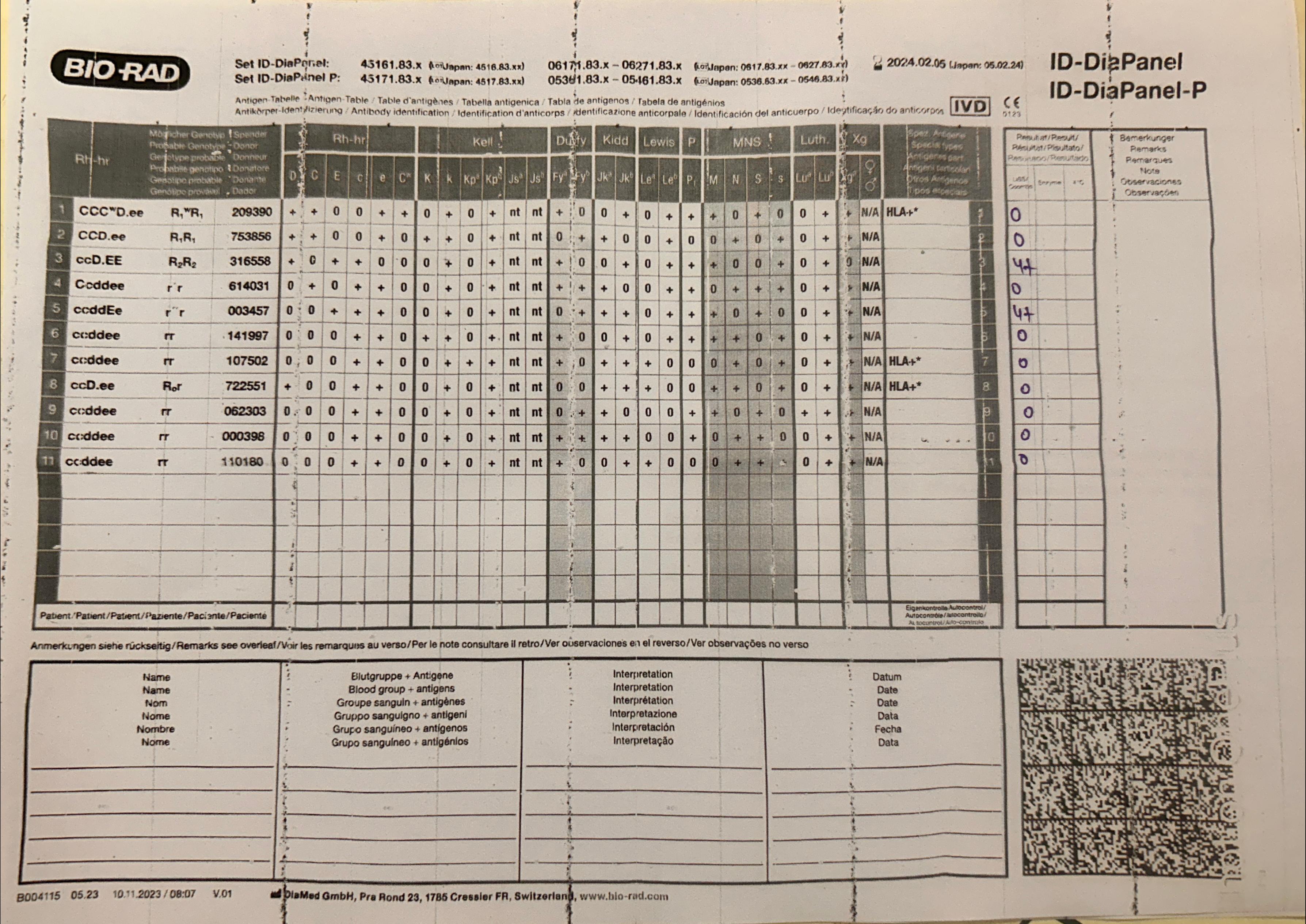 Pathology Outlines - Antibody identification & panel interpretation