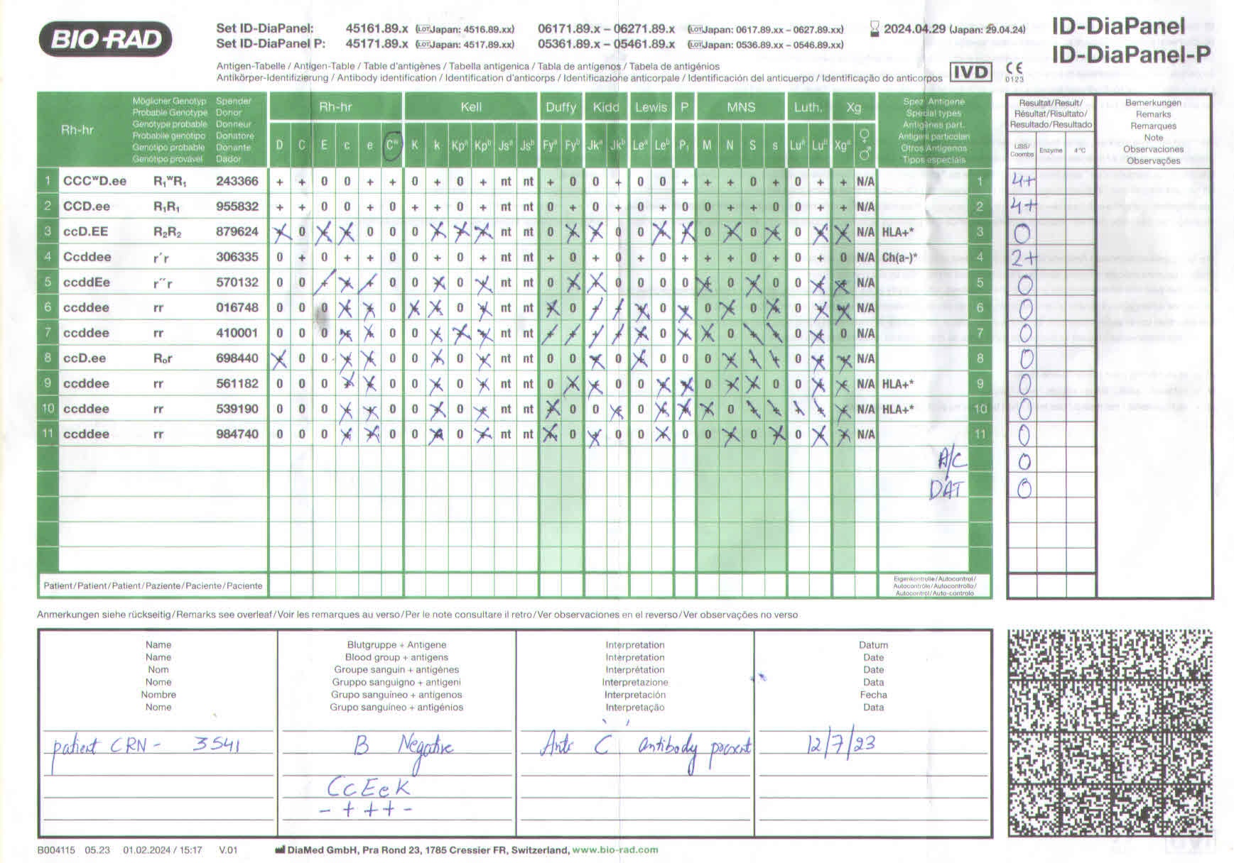 Pathology Outlines - Antibody identification & panel interpretation